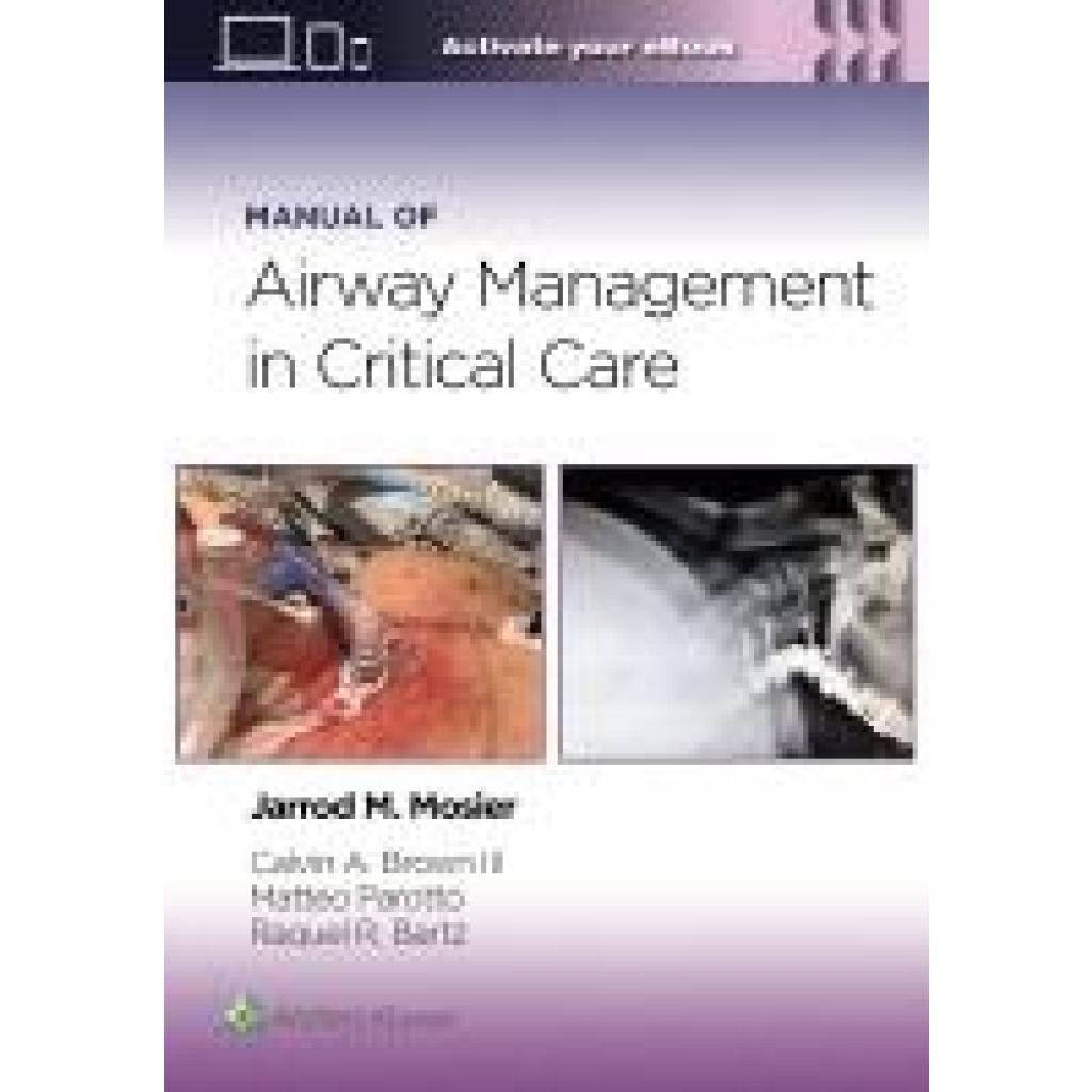 Manual of Airway Management in Critical Care: Print + Digital with Mul